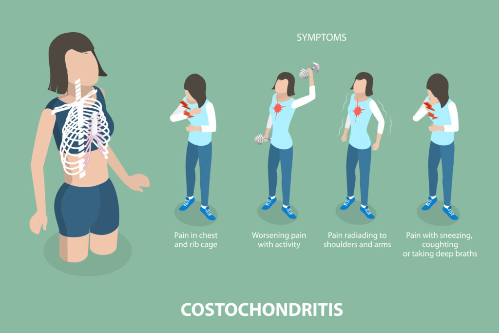 Costochondritis: Symptoms, Causes, and Treatment